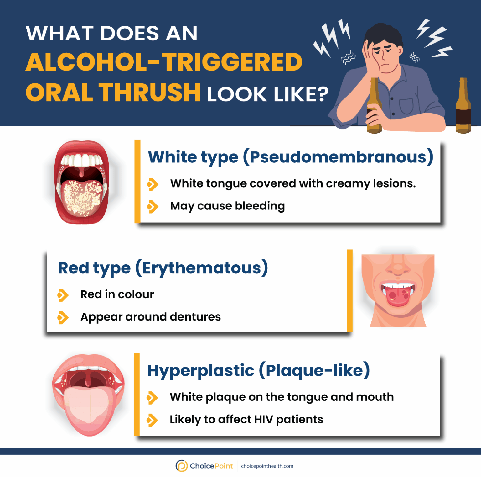 Oral Thrush and Alcohol Use: Risks and Recovery Tips - ChoicePoint
